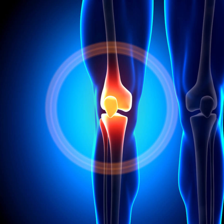 Knee Pain & Injury Care in Austin & DFW - Direct Orthopedic Care
