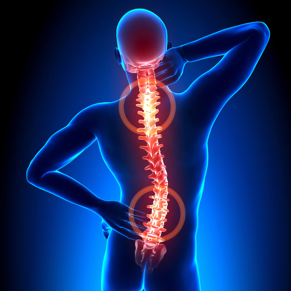 Neck & Spine Care in Austin & DFW - Direct Orthopedic Care