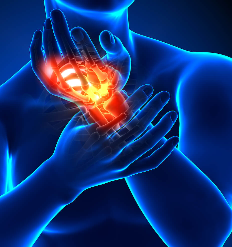 Hand & Wrist Pain Treatment in Austin & DFW - Direct Orthopedic Care