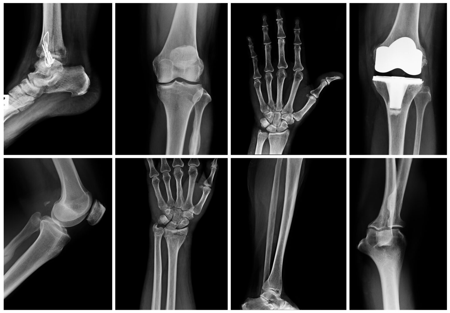 Do You Need an MRI, CT Scan, or X-Ray? How Orthopedic Providers Decide ...