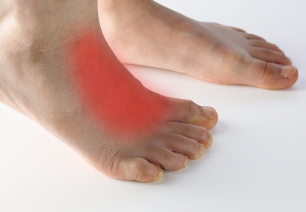 Extensor Tendonitis: Why the Top of Your Foot Hurts and How to Treat It ...
